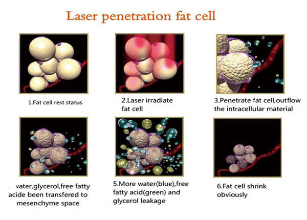 Laser Lipo | Le Beaut